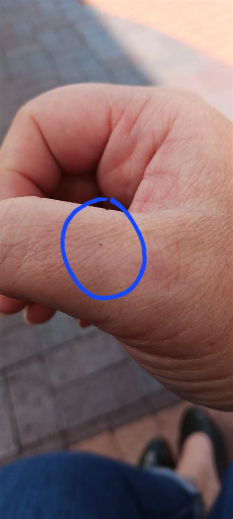 Teeny Tiny Bug What Is It R Whatisthisbug