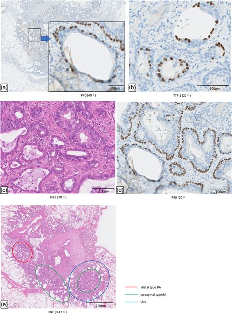 A Type Ii Alveolar Epithelial Cells Showed A Bilayer Arrangement With
