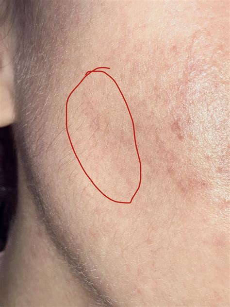 Pain Under My Right Cheekbone At Lisette Webb Blog