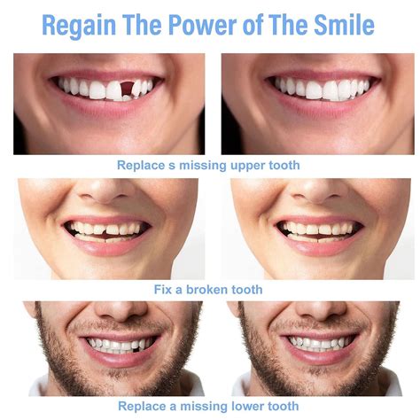 Fake Teeth Repair Kit Moldable False Tooth For Fixing Broken