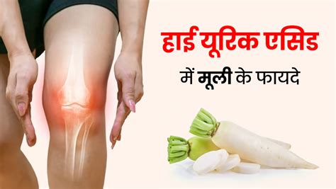 गठिया रोगियों के लिए फायदेमंद है मूली यूरिक एसिड कम करने में करती है
