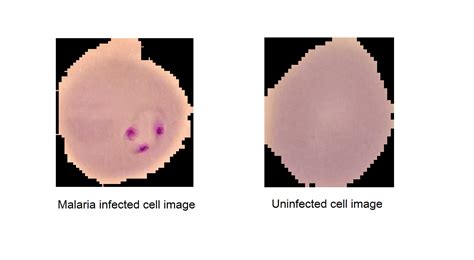 Github Soham1024 Malaria Cell Image Classification Using Cnn