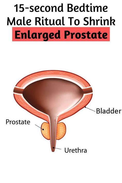 Best 12 Best Natural Ways To Shrink An Enlarged Prostate Stylepersuit