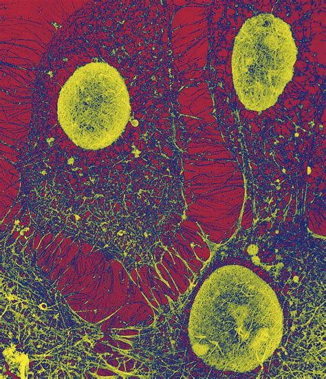 Cytoskeleton Sem By Science Photo Library