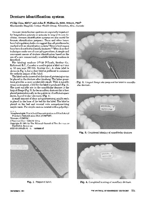Pdf Denture Identification System