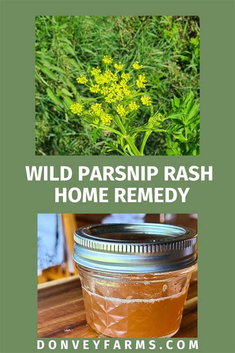 What Is Wild Parsnip How To Treat Wild Parsnip Rash Donvey Farms