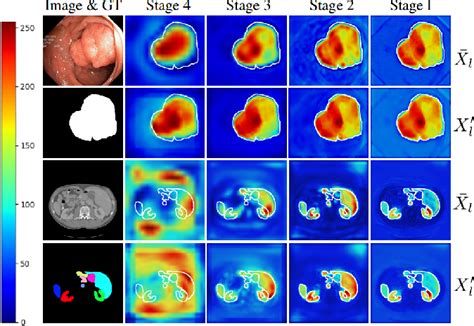 Figure 10 From Global And Local Feature Reconstruction For Medical Image Segmentation Semantic