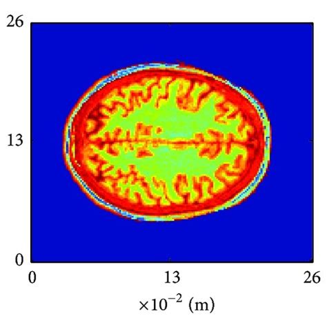 Reconstruction In The Absence Of Stroke The Left Panel Is The Download Scientific Diagram