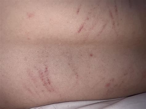 Sex Scratches Rcheatingexposed