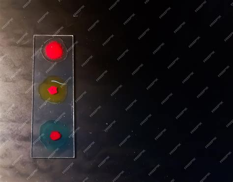 Test De Groupe Sanguin Par Méthode Dagglutination Sur Lame Photo Premium