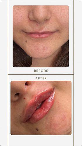 بهترین آرایشگاه یا کلینیک زیبایی تهران و مشهد کجاست؟ ماتیکی