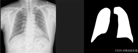 深度学习之基于pytorch框架的unet分割模型搭建学习unet模型搭建 Csdn博客