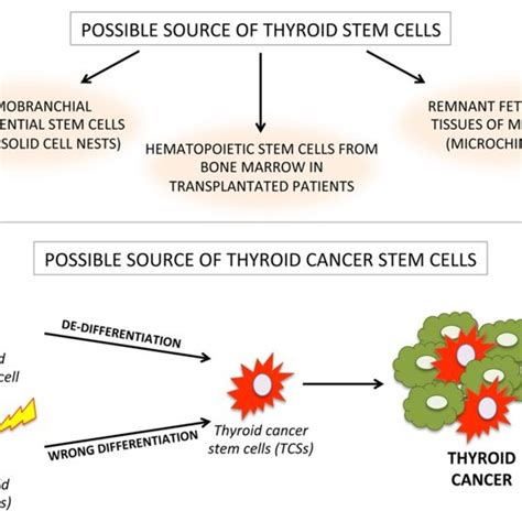 Schematic Representation Of Multistep Carcinogenesis In Thyroid Cancer