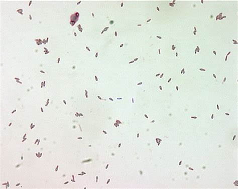 Free Picture Gram Micrograph Clostridium Botulinum Type Thioglycollate Broth Incubated 48hrs