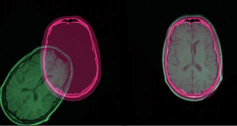 图像配准 图像配准：从sift到深度学习 《learnpython Python 学习笔记》 极客文档