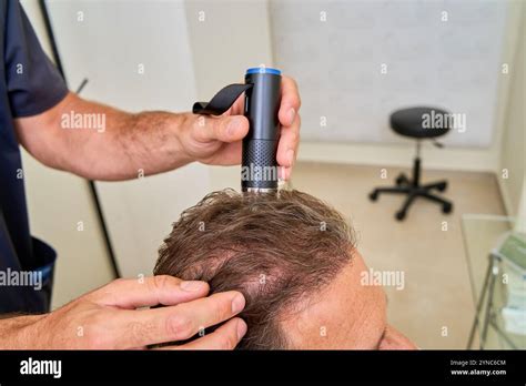Doctor Performing A Hair And Scalp Examination Using A Diagnostic Tool On A Patient Stock Photo