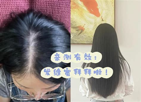 🌿浮萍侧柏叶：生发秘籍💪