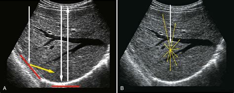 Physics Of Ultrasound Clinical Tree