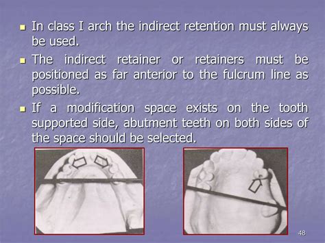 Principles Of Rpd Designppt