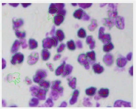 Using Sbf Filter Final Image Classification Download Scientific Diagram