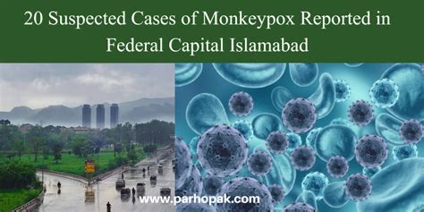 Federal Capital Reported 20 Suspected Cases Of Monkeypox