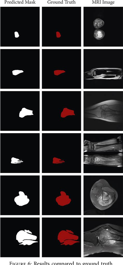 Figure 1 From A Residual Fusion Network For Osteosarcoma Mri Image