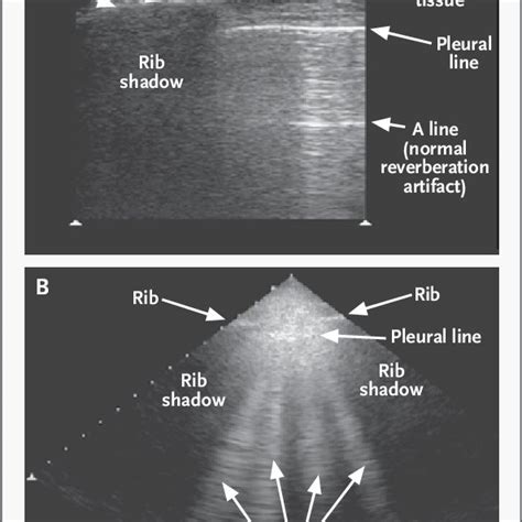 On Color Doppler The Mass Was Pulsatile Download Scientific Diagram