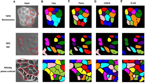 Figure 3 From Learn To Segment Single Cells With Deep Distance Estimator And Deep Cell Detector