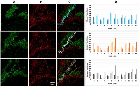 Colocalization Analysis Of Cytoplasmic Actin Isoforms Distribution In