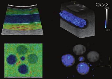Three Dimensional Elastography Of Phantom Objectives The Phantom Download Scientific Diagram
