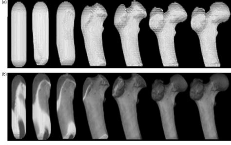 Figure 1 From An Automated Method To Estimate Femoral Shape And Mineral Mass Semantic Scholar