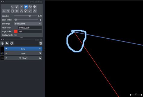 Some Edges Of Polygon Extend To Infinity Usage Issues Image Sc Forum