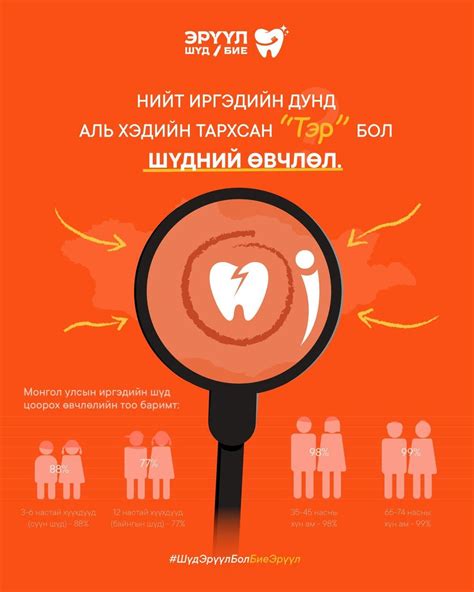 “Тэр” гэдэг нь шүдний өвчлөл байжээ