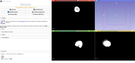 nii image not displaying with simpleitk gui python itk