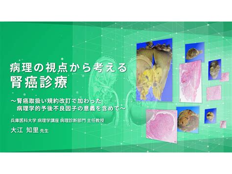 【腎細胞癌】病理の視点から考える腎癌診療 〜腎癌取扱い規約改訂で加わった病理学的予後不良因⼦の意義を含めて〜 Msd Connect