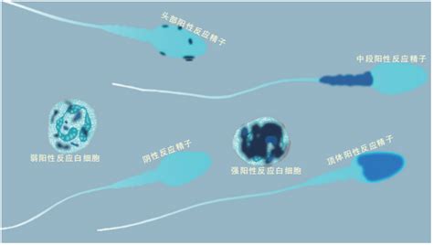 精液活性氧类物质（ros）染色液（nbt法） 精子受精功能检测试剂 精子功能分析系列 产品展示 深圳市博锐德生物科技有限公司