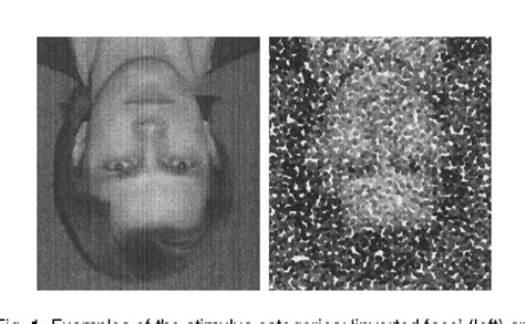 Figure 1 From Face Selective Processing In Human Extrastriate Cortex Around 120 Ms After