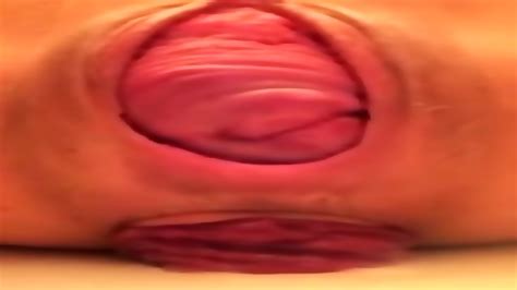 Prolapsing Both Holes