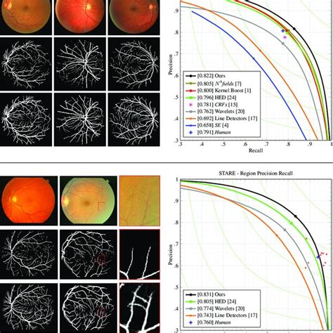 Pdf Deep Retinal Image Understanding