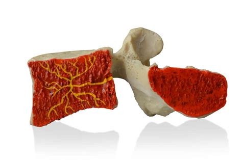 Basivertebral Nerve Lumbar Model Dynamic Disc Designs