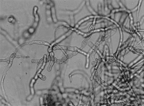 Fungal Elements From The Fi Rst Growing Colony With Thick Walled Download Scientific Diagram
