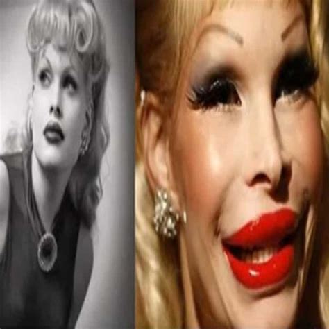 Worst Celebrity Plastic Surgery Disasters