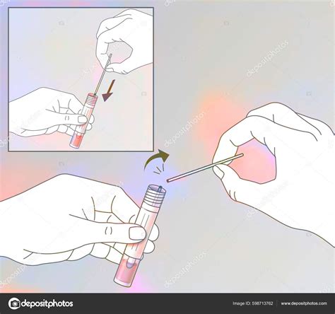 Wet Swab Vaginal Self Sampling Stock Illustration By Imagepointfr