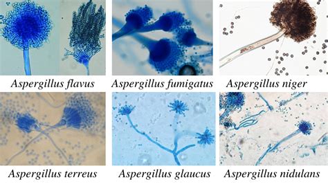 Differential Identification Of Aspergillus Spp At Eloy Estes Blog