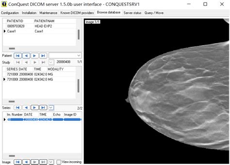 Analysis Of Dicom Transfer Protocols A Random Blog