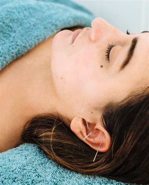 Fertility Acupuncture For Ivf Pregnancy Macleod Melbourne