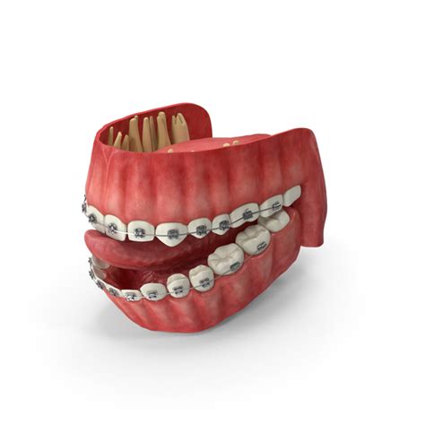 Human Mouth With Self Ligating Steel Dental Braces Png Images And Psds