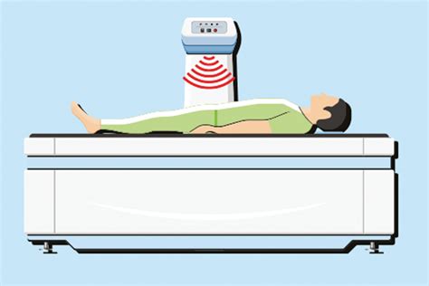 Dxa Scan Irish Osteoporosis Society
