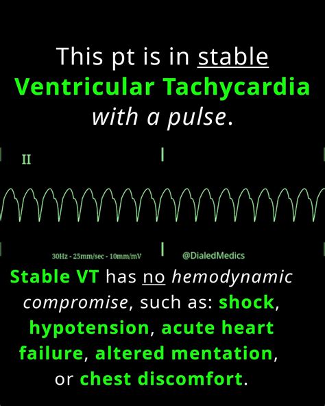 Monomorphic And Polymorphic Ventricular Tachycardia Real World Use Of