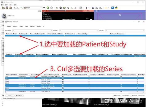 在3d Slicer中同时加载和测量多个序列
